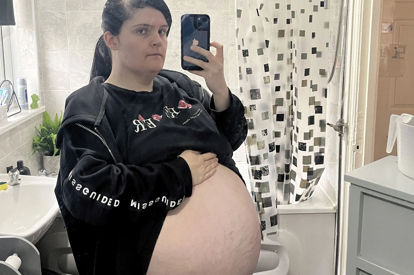 (FOTOS) Mujer tenía quiste de casi 16 kilos que la hacía verse ...